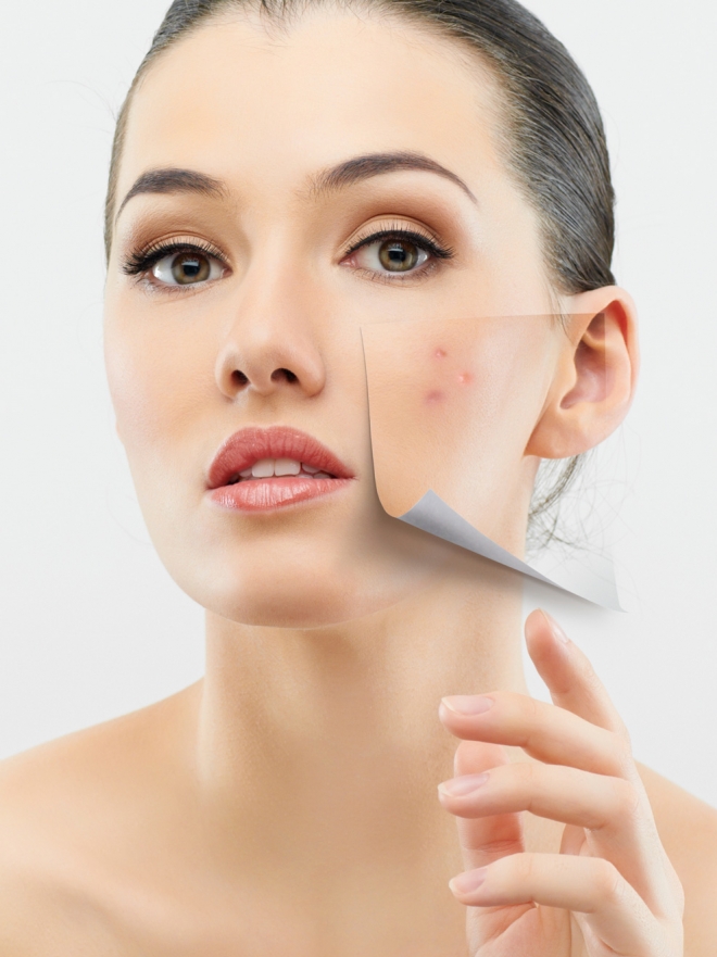 Los problemas más comunes (y odiados) de nuestra piel